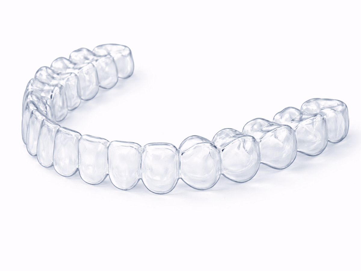 Can You Get Veneers on Crooked Teeth? What to Know